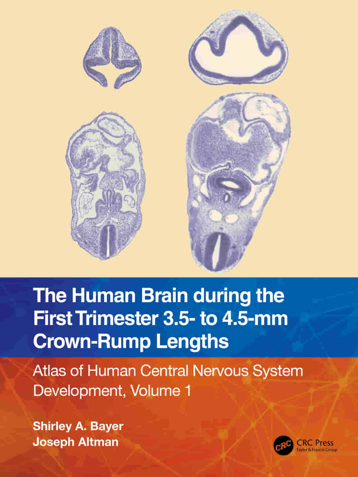 The Human Brain during the First Trimester 3.5- to 4.5-mm Crown-Rump ...